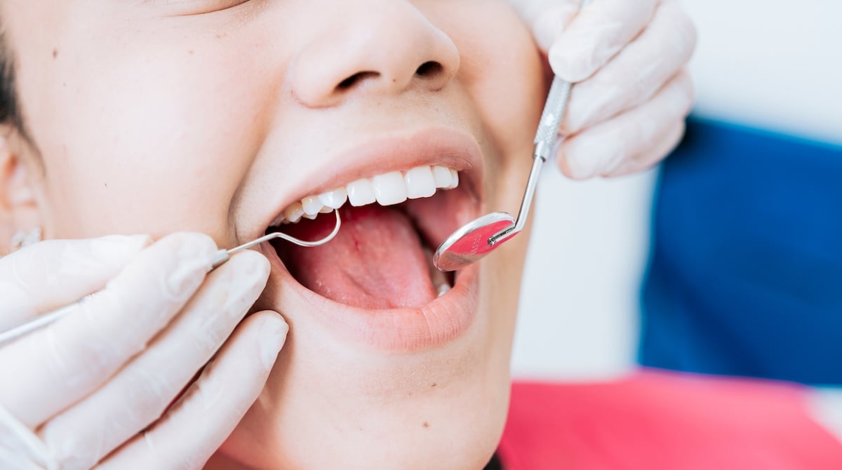 Grinded Teeth Repair: What Are Treatment Options?